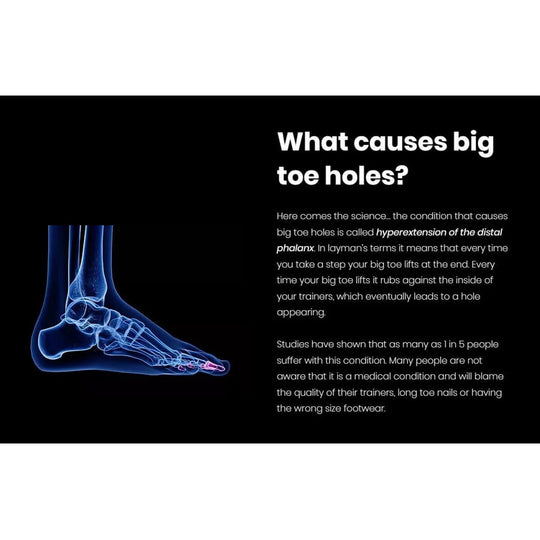 Big Toe Hole Preventer Patches – Alexandra Sports